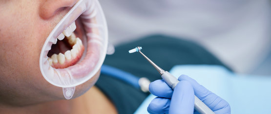 Ivoclar Workflow für die Zahnarztpraxis